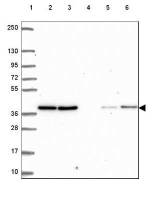 VPS26A Antibody (NBP2-49257): Novus Biologicals