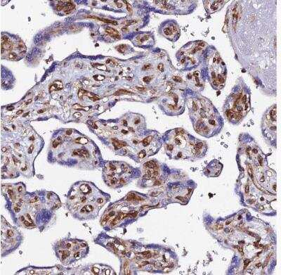 VRL1 Antibodies: Novus Biologicals