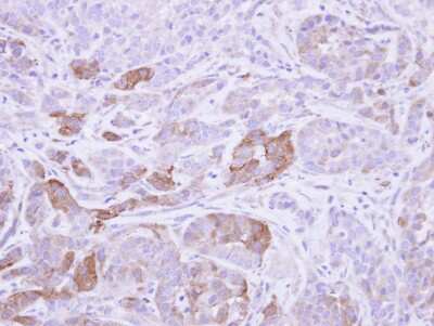 Villin 1 Antibody (NBP1-32841): Novus Biologicals