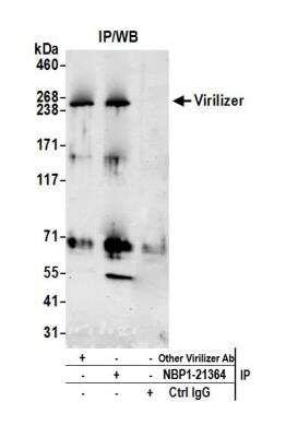 Virilizer Antibody (NBP1-21364): Novus Biologicals