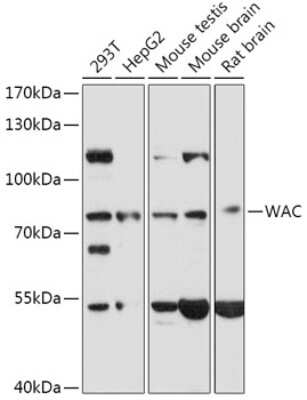 WAC Antibody (NBP2-94374): Novus Biologicals