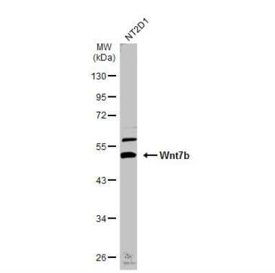 Wnt-7b Antibody (NBP2-15163): Novus Biologicals