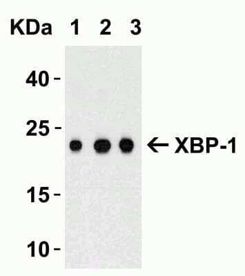 XBP1 Antibodies: Novus Biologicals