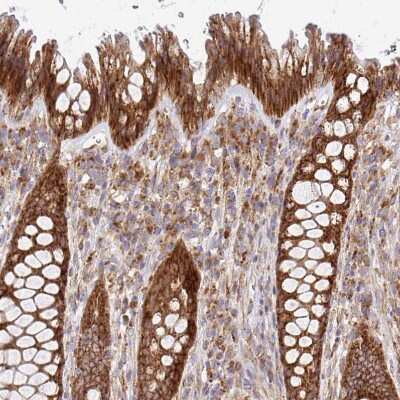 alpha-L-Iduronidase/IDUA Antibody (NBP2-49126): Novus Biologicals