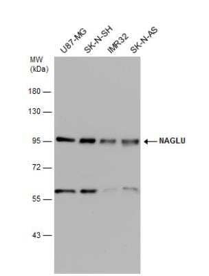 alpha-N-acetylglucosaminidase/NAGLU Antibody (NBP2-19465): Novus ...