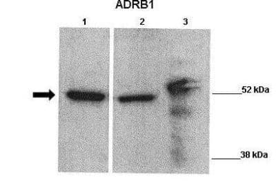 beta-1 Adrenergic R/ADRB1 Antibody (NBP1-59007): Novus Biologicals