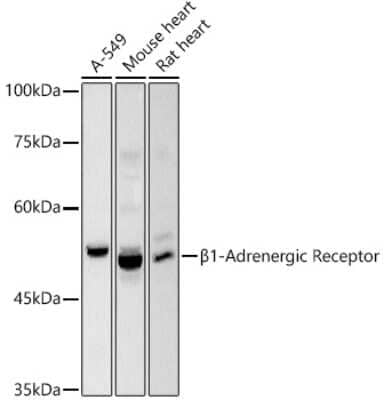 beta-1 Adrenergic R/ADRB1 Antibody (NBP3-16089): Novus Biologicals