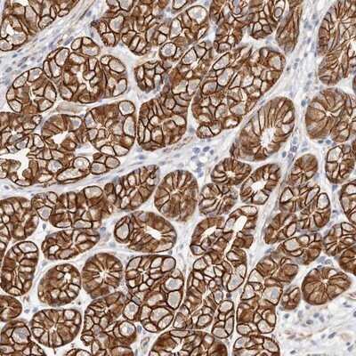 beta-Catenin Antibody (NBP1-89990): Novus Biologicals