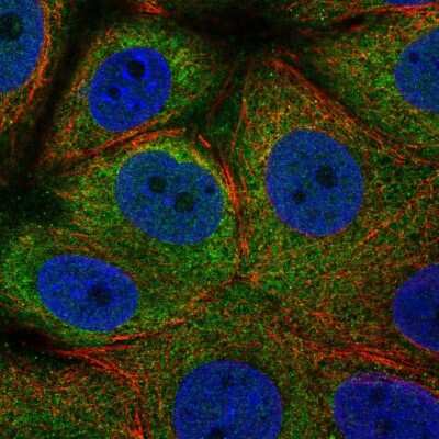 eIF2 alpha/EIF2S1 Antibody (NBP2-49428): Novus Biologicals