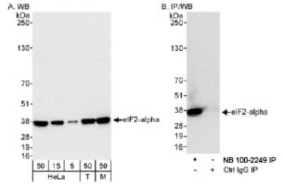 eIF2 alpha/EIF2S1 Antibody (NB100-2249): Novus Biologicals