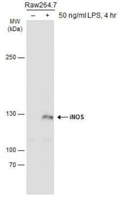 iNOS Antibodies: Novus Biologicals