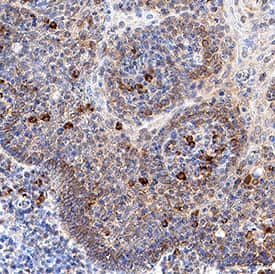 B7-2/CD86 Antibodies: Novus Biologicals