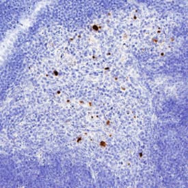 CXCL10/IP-10/CRG-2 Antibody (1050502) [Unconjugated] (MAB4661): Novus ...