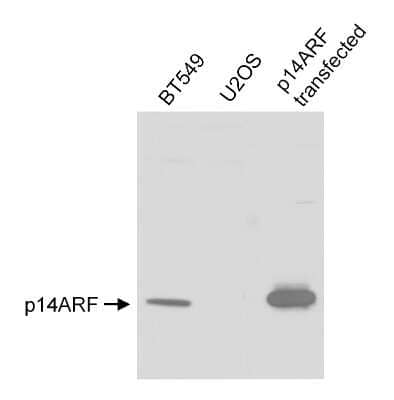 p14ARF/CDKN2A Antibody (NB200-158): Novus Biologicals
