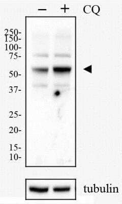 p62/SQSTM1 Antibodies: Novus Biologicals