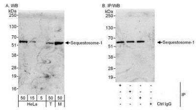 p62/SQSTM1 Antibody (NBP1-49954): Novus Biologicals