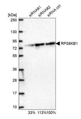 p70 S6 Kinase/S6K Antibody (NBP2-38448): Novus Biologicals