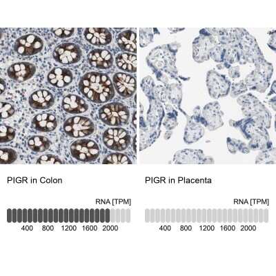pIgR Antibodies: Novus Biologicals