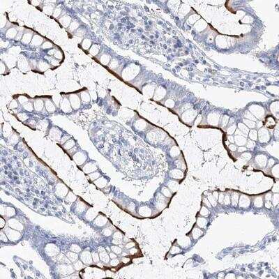 villin-like Antibodies: Novus Biologicals