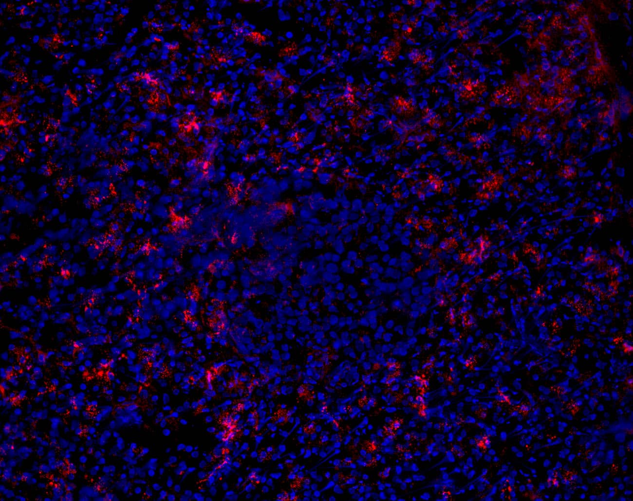 EMP1 Antibody (NBP2-30846): Novus Biologicals