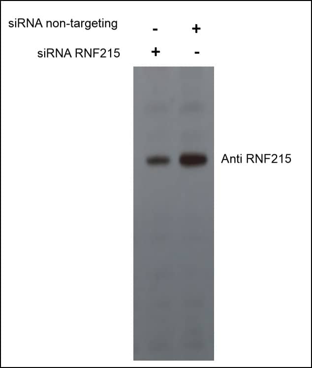 RNF215 Antibody (NBP1-92342): Novus Biologicals
