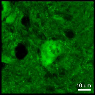 beta-Synuclein Antibody (EP1537Y) (NB100-79903): Novus Biologicals